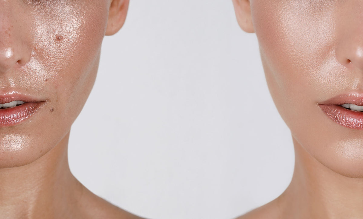 The What, Why and Where of Sebum! | Cygnet Skin